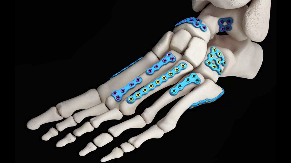 Resources - Unite Foot and Ankle